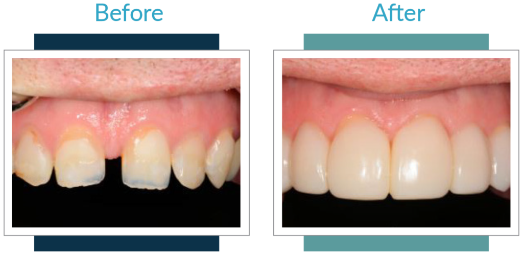 Best Dentists in Iowa | Family 1st Dental | The Bioclear Method ...